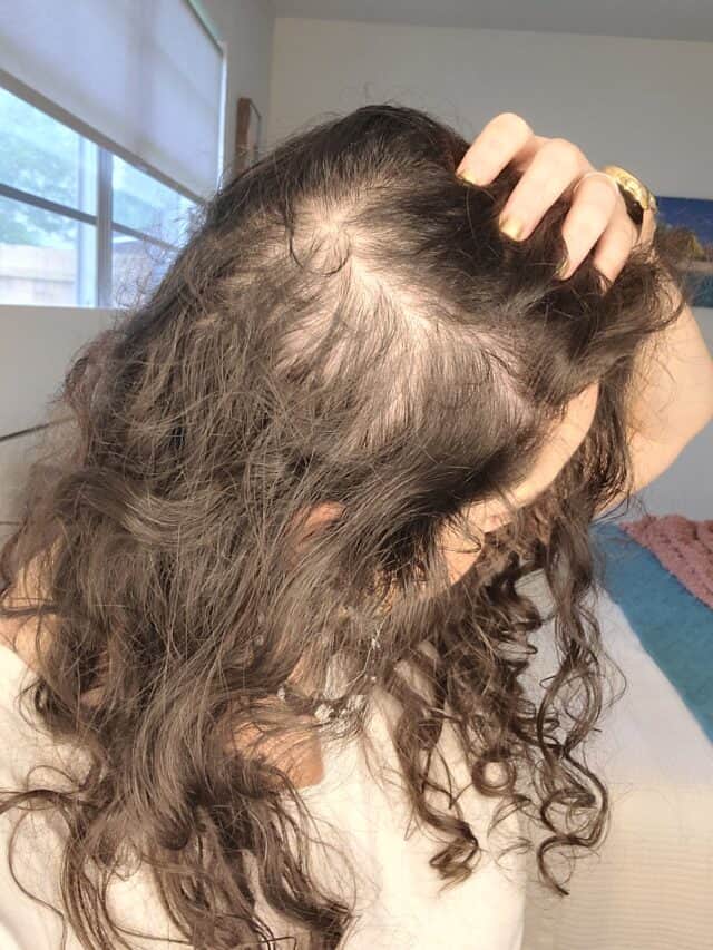 Your Ultimate Hair Density Guide + How To Choose Products - The ...